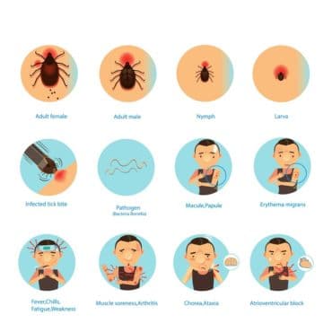 ¿Conoces los síntomas de la enfermedad de Lyme?