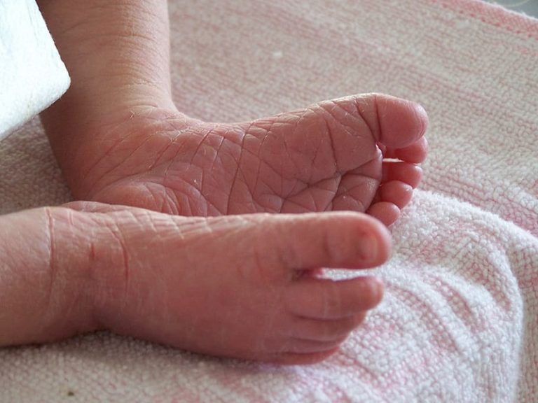 Los mejores cuidados de la piel del bebé… No te los pierdas