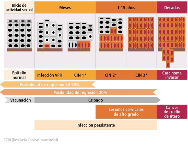 Virus del papiloma humano y cáncer cervicouterino